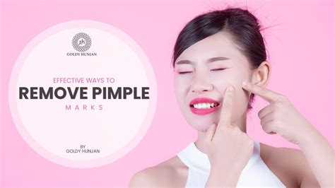 Remove Pimple Marks Some Effective Ways Goldy Hunjan Makeup Studio