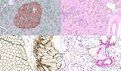 Masterclass Webinar Optimizing Ai Based Nuclear And Membrane