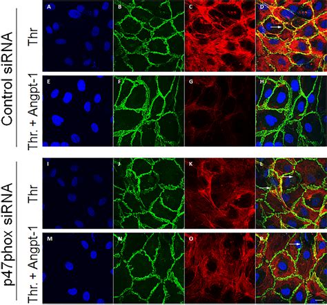 P47phox Enables Angpt 1 To Counteract Cellular Structural Download