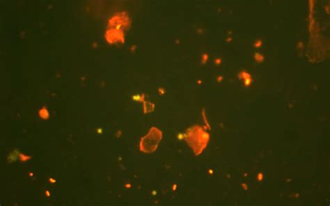 Fecal Indicator Bacteria And Rainfall