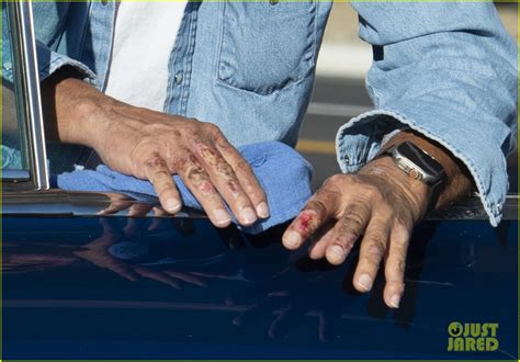 Jay Leno Appears In Good Spirits After Being Released From Burn Center