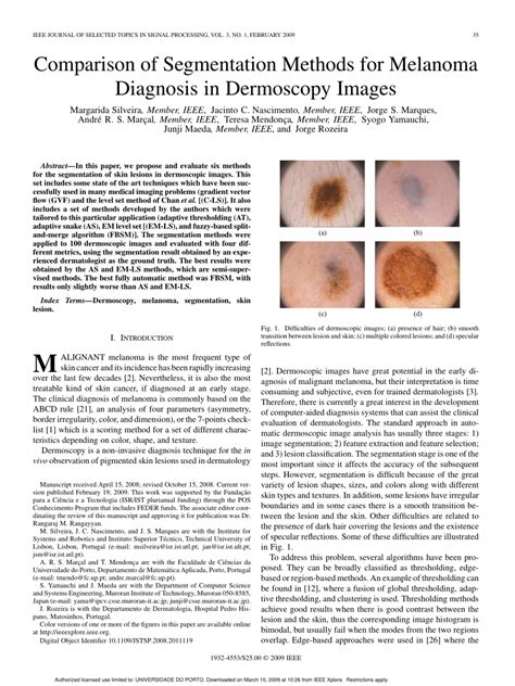 pdf comparison of segmentation methods for melanoma diagnosis in