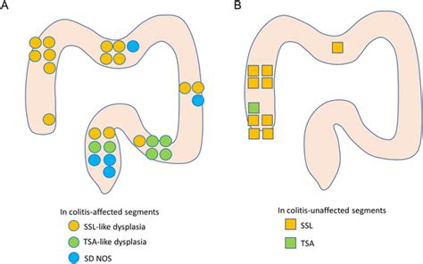Colitis Plos One