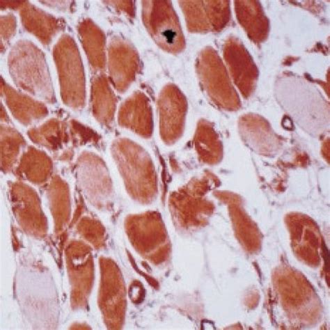 大通量免疫组化染色仪 免疫组化试剂 科研实验专用试剂盒 厦门通灵生物医药科技股份有限公司