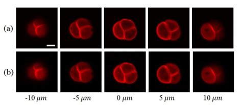 Faster 3d Biomedical Imaging With Compressive Sensing Two Photon Microscopy