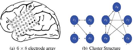 1 A Spatial Placement Of Ecog Electrodes On An Epileptic Patient 1 B Download Scientific