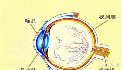 爱眼底 年龄相关黄斑变性的治疗方法有哪些早发现早治疗 知乎