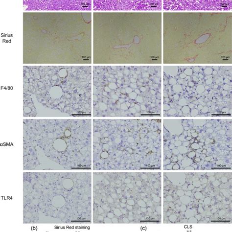 Analysis Of The Effect Of Lps A H And E Staining B Sirius Red Download Scientific Diagram