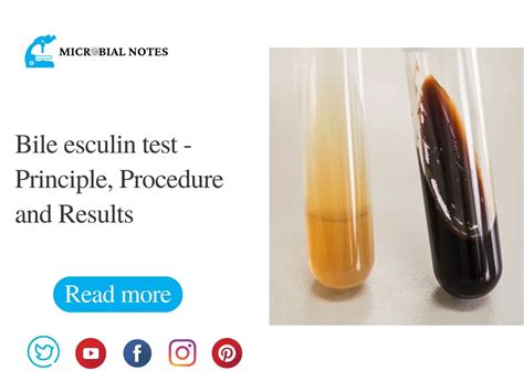 Bile Esculin Test Principle Procedure And Results