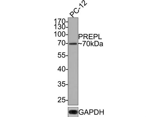 Prepl Recombinant Monoclonal Antibody Je65 64 Ma5 44739