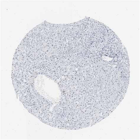 Tissue Expression Of Cebpb Staining In Liver The Human Protein Atlas