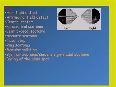 Visual Field Analysis Interpretation PPTX Eye And Vision Conditions Diseases And Conditions