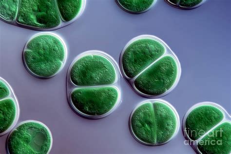 Chroococcus Turgidus Algae 3 Photograph By Frank Fox Science Photo Library Fine Art America