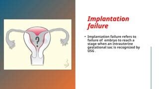 Recurrent Implantation Failure In Ivfpptx