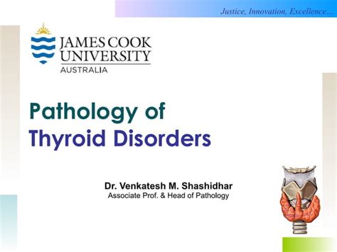 Pathology Of Thyroid And Endocrine Disorders Ppt Thyroid Disorders Endocrine And Metabolic