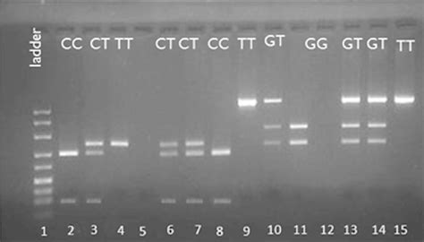 Polymerase Chain Reaction Restriction Fragment Length Polymorphism