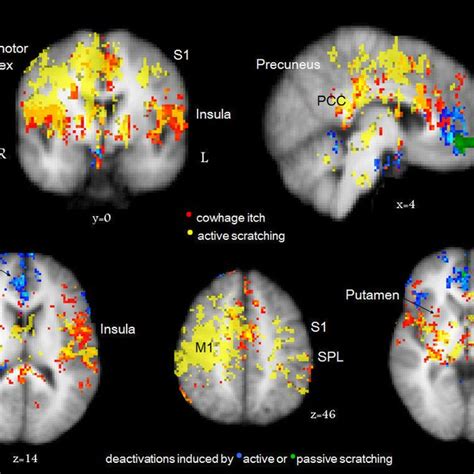 Overview Of The Itch Scratch Cycle Activations Induced By Actively
