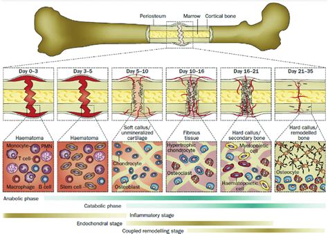 does heat help heal fractures at ronald alvarez blog