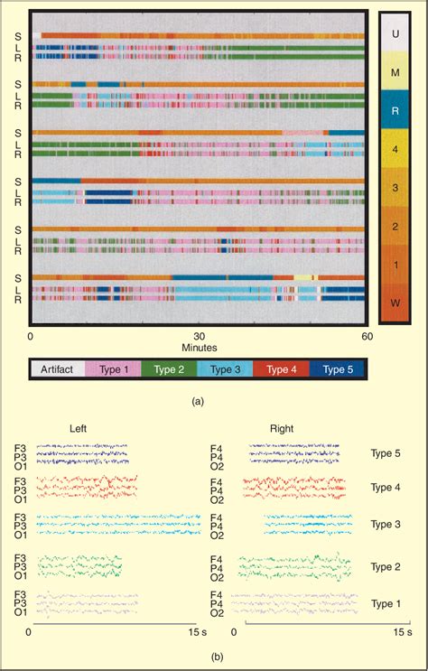 Figure 4 From Long Term Eeg Compression For Intensive Care Settings