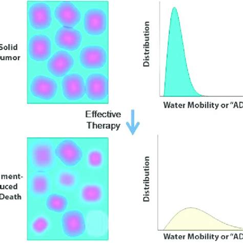 Restricted Diffusion Within Rectal Cancer With Extension Into The Download Scientific Diagram