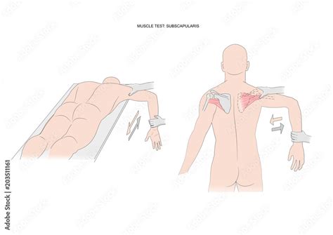 Subscapularis Test
