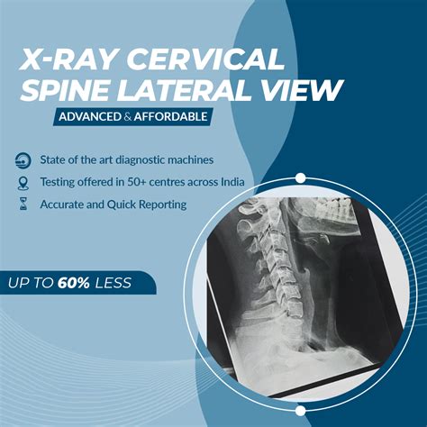 Cervical Spine Lateral View X Ray Aarthi Scans And Labs