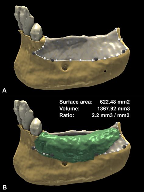 Efficacy Of The Augmentation A Surface Area Of The Augmentation Download Scientific Diagram