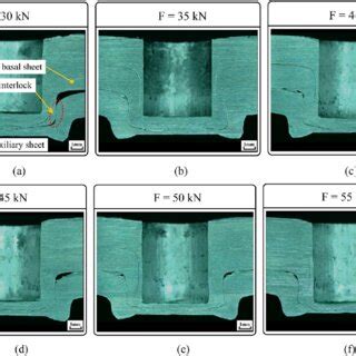E The Interlock Value And Neck Thickness Of The Upper Interlock Download Scientific Diagram