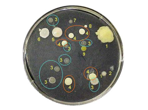 Medical Laboratory And Biomedical Science Interpreting Plates Colony Morphology