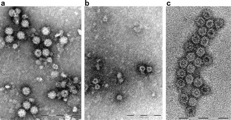 Electron Micrograph Of Yeast Generated Recombinant Rat Hev Capsid