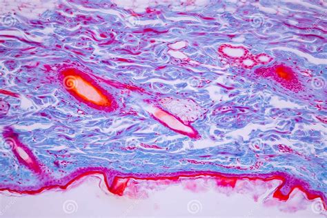Characteristics Tissue Of Human Scalp Skin Human From General Body