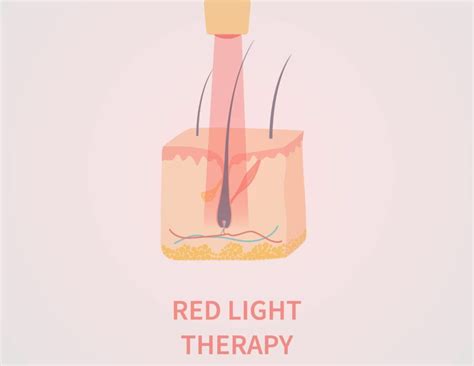 5 Benefits Of Low Level Laser Light Therapy For Hair Loss Boost Hair Growth Naturally Led