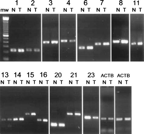 Rt Pcr Validation Of Array Derived Data Rt Pcr Products For