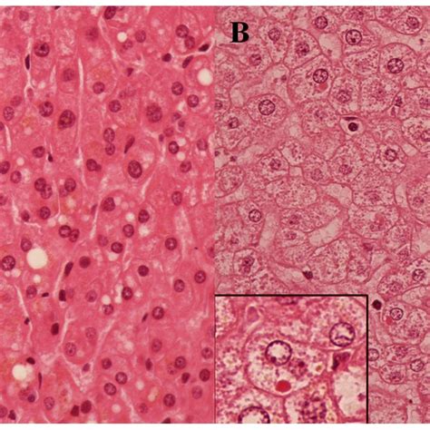 Liver Histology Slides Stained With Hematoxylin And Eosin Representing Download Scientific