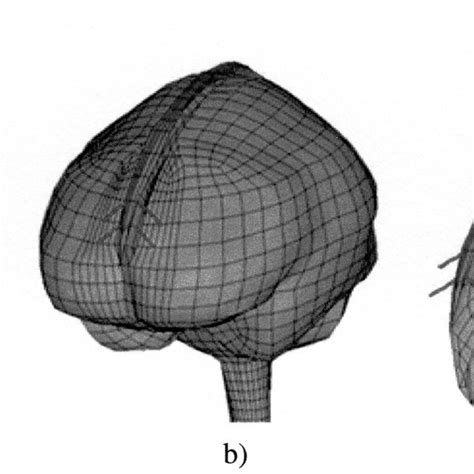 Finite Element Mesh Of A Skull Bone B Brain With Superior