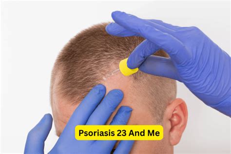 Discover The Beauty Of Psoriasis With A Stunning 3d Model Psoriasis 3d Model