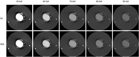 Effect Of A Novel Intracycle Motion Correction Algorithm On Dual Energy