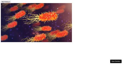 Annotation Forked Codesandbox