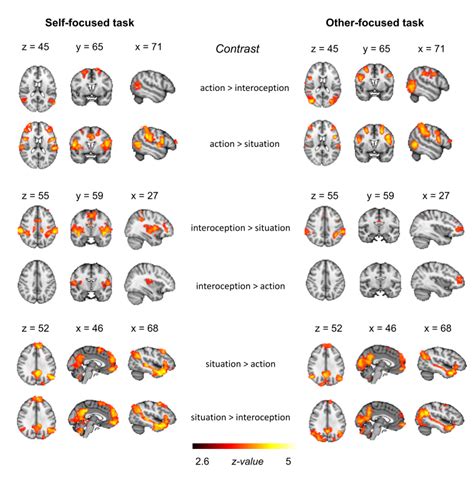 2 Shared States Using Mvpa To Test Neural Overlap Between Self Focused Emotion Imagery And