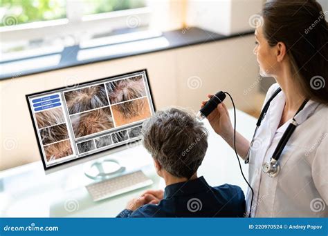 Hair Scalp Analysis In Clinic Man With Hair Fall Stock Photo Image Of People Hairdressers