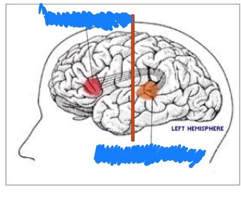 Mapping Aphasia Ch5 Flashcards Quizlet