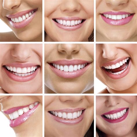 Teeth Treatment For Perfect Smile