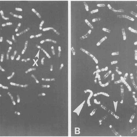 A B Gc Bands In Cattle Chromosomes In A Male A And A Female B
