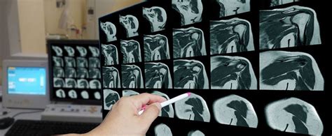 Imaging Innovators Recognized Awarded At Rsna 2019 Radiology Group