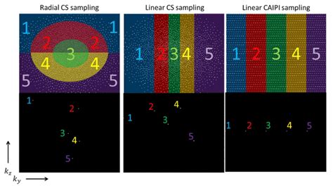 1 Different Sampling Patterns Of A Variable Density Poisson Disk The