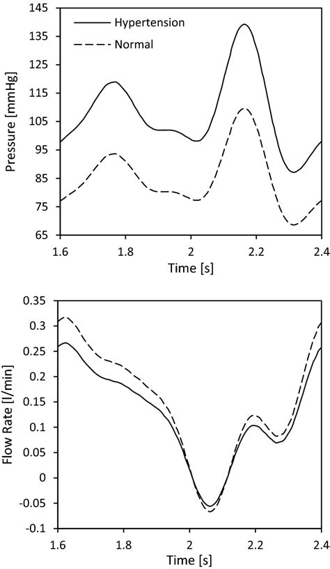 Pulsatile Blood Flow Waves Used In This Study For Normal And Download Scientific Diagram