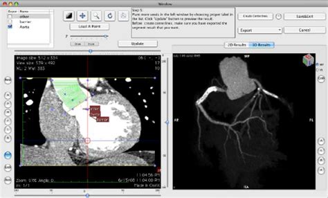 gui for interactive segmentation left side showing original seeds