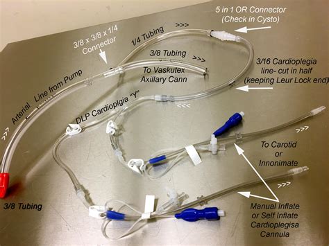 A Locums Scrapbook Modifying The Ecc For Antegrade Cerebral