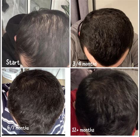 Rogaine Only Results
