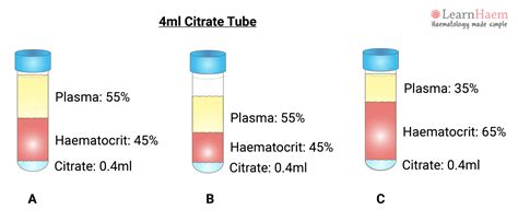 Sample Collection Learnhaem Haematology Made Simple